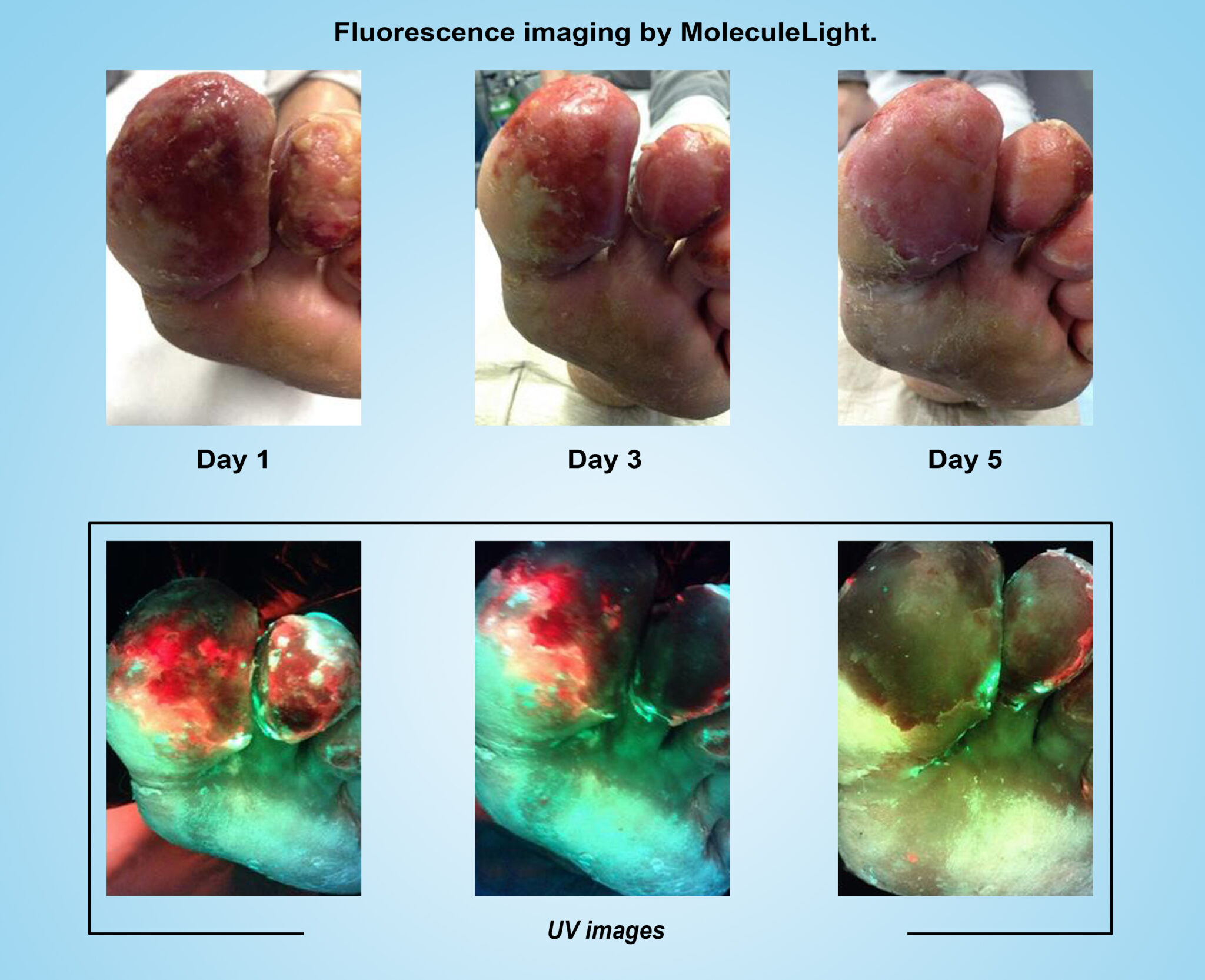 ANTIMICROBIAL STEWARDSHIP IS EVERYONE’S RESPONSIBILITY